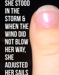 People With Clubbed Thumbs Will Get These 12 Photos